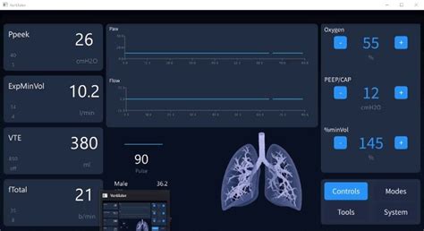 Ali Sharifi On Linkedin Ventilator Qt Qml Cpp جویایکار