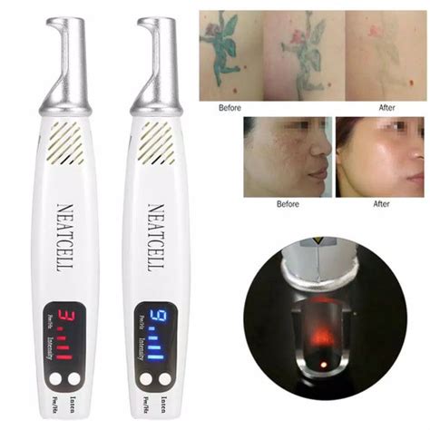 Jual Alat Laser Pico Second Portabel Facial Tatto Flek Biru Jakarta Pusat Alat Salon