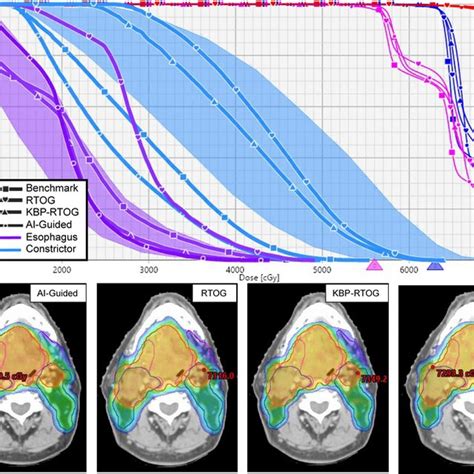 Single Axial Plane And Corresponding Dose‐volume‐histogram For Example