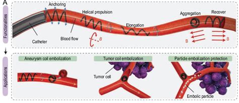 Figure 1 From Endovascular Embolization By A Magnetic Microfiberbot Semantic Scholar