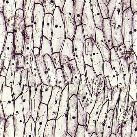 Epidermide Della Cipolla Con Le Grandi Cellule Sotto Il Microscopio