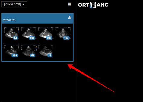 Stone Viewer And Dicom Sending Format Google Groups Archive Orthanc