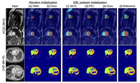 Keypoint Augmented Self Supervised Learning For Medical Image