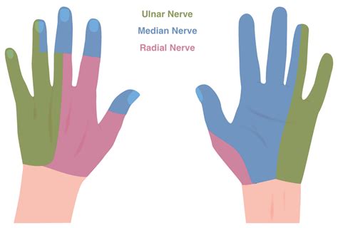 Hand Numbness Dallas Hand Surgeon Dr Azouzazouz Hand Surgery