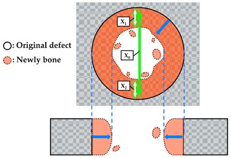 Illustration Of Top And Cross Sectional Views Of The Bone Formation