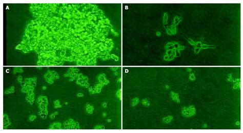 Effects Of Phosphorothioate Anti Sense Oligodeoxynucleotides On Colorectal Cancer Cell Growth