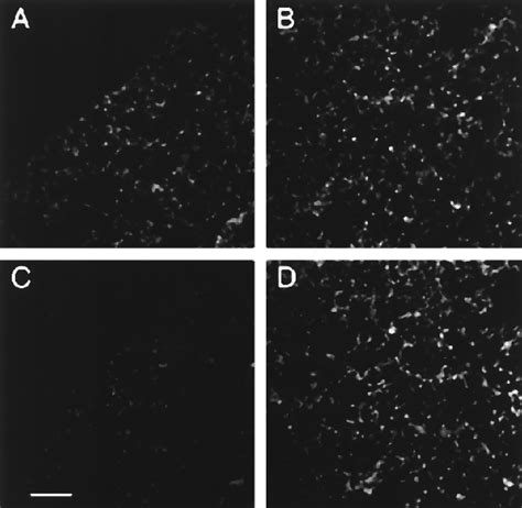 Apoptosis In Hyperoxia Injured Lungs Sections Of Lungs From Control