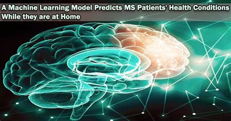A Machine Learning Model Predicts Ms Patients Health Conditions While They Are At Home Qs Papers