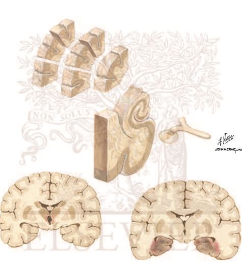 Memory Circuits