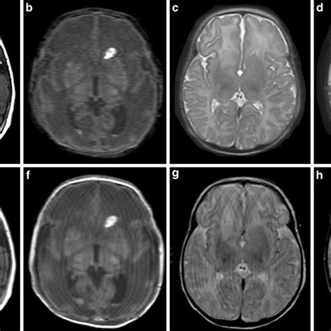 Mri Image Of The Anatomy Of Hetero Sexual Intercourse 1 Download