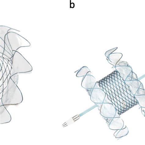 Lumen Apposing Metal Stent Axios Boston Scientific Marlborough Download Scientific Diagram