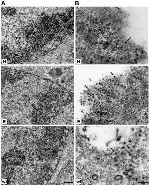 Electron Micrographs Of Cells Infected With Mutant H Or E Or Wt Py Download Scientific
