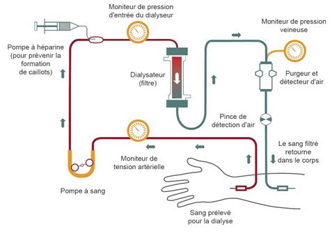 Hémodialyse Un Service Dexcellence à Lhôpital Cmq Premiere