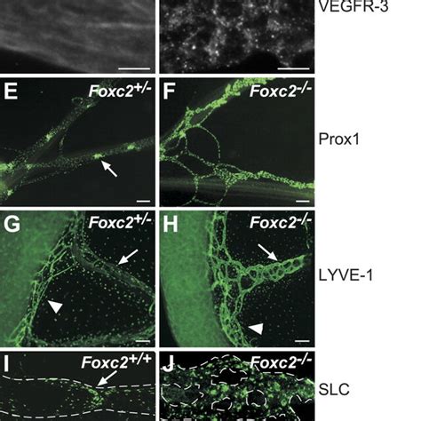 Expression Of Lymphatic Endothelial Markers During Formation Of