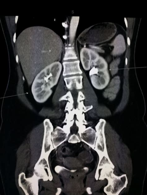Pin On CT Scans