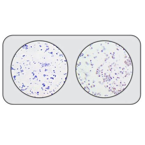2 Core Sv 40 Cell Line Microarray Cancer Diagnostics Inc