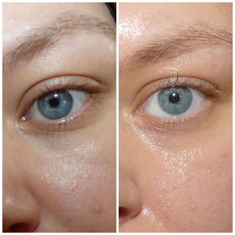 Before And After Retinol Eye Serum Beauty Insider Community