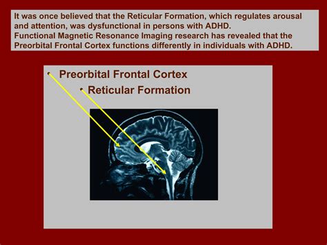 Attention Deficit Hyperactivitydisorder Powerpoint Ppt Illegal Drugs Tobacco Ecigarettes