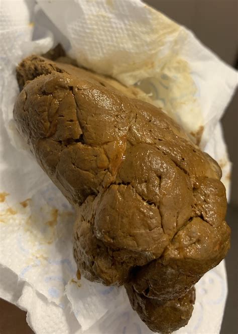 What Do They Look For In Poo Samples At Nancy Townsend Blog