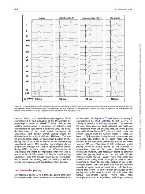 Suad114 Pdf Pacing Conduction System Pacing Pdf