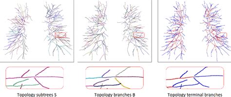 Figure 1 From Automatic Pulmonary Artery And Vein Separation Algorithm Based On Multitask