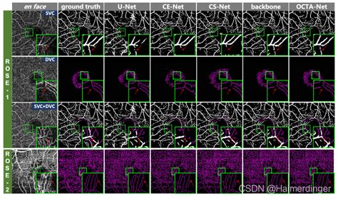 近两年值得阅读的十篇医疗图像分割文献multi Organ Segmentation Over Partially Labeled Da Csdn博客