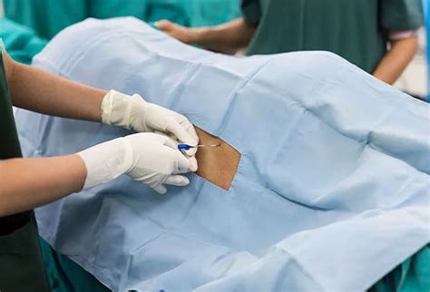 How Long Does An Epidural Nerve Block Last