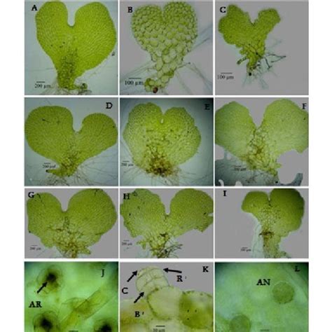 Development Stages Of The Gametophyte And Sex Organs Of Pteris A C