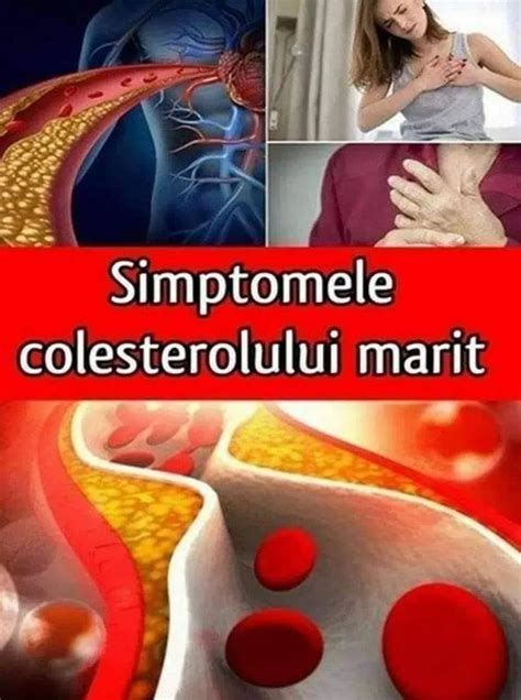 Cele 10 Simptome Ale Nivelului Crescut De Colesterol Feminaro