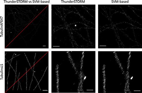 Machine Learning Approach For Single Molecule Localisation Microscopy