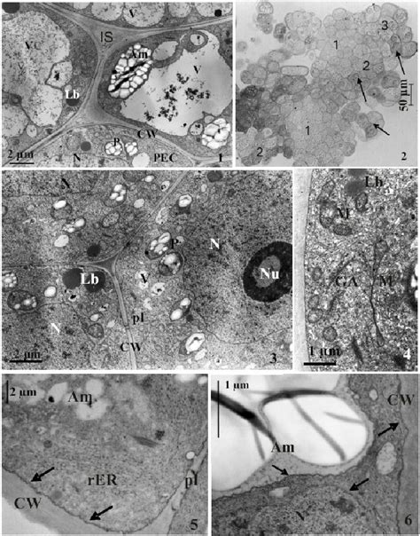 Ultrastructure Of Cell Aggregates Cultured In Ms Maintenance Medium Download Scientific Diagram