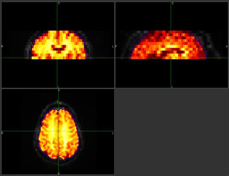 Qbold Tutorial — Quantiphyse Documentation