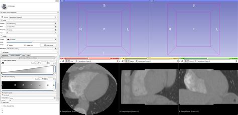 volume rendering does not appear in 3d view support 3d slicer community