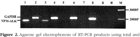 Figure 1 From Utility Of Linearly Amplified Rna For Rt Pcr Detection Of