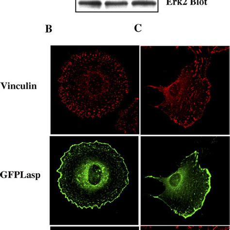 Subcellular Localization Of Lasp 1 In Spreading And Migrating Cells