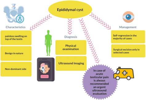 Epididymal Cyst Diagram