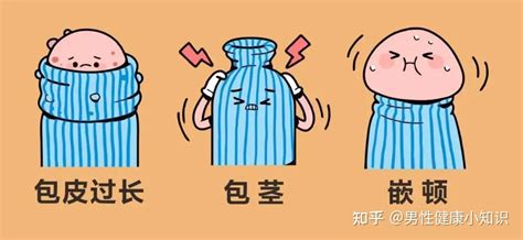 关于包皮包茎手术你关心的问题都在这 知乎