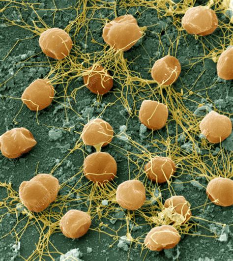 Pyrococcus Furiosus Archaea Sem Stock Image B244 0045 Science Photo Library