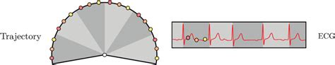 Strict Ecg Gating Uses One View Per Cardiac Phase From Each Heart Cycle