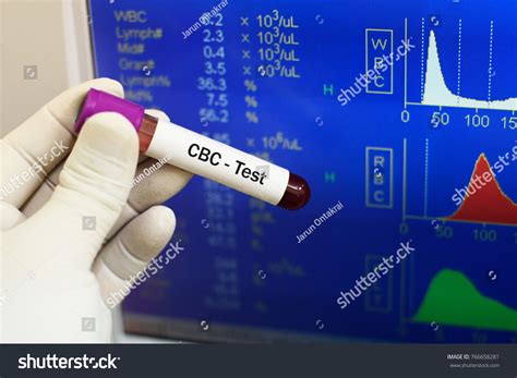 Blood Sample Complete Blood Count Cbc Stock Photo Shutterstock