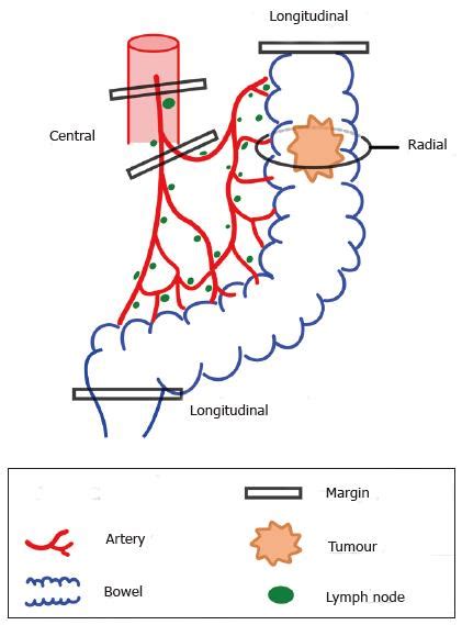 Assessment Of Lymph Node Involvement In Colorectal Cancer