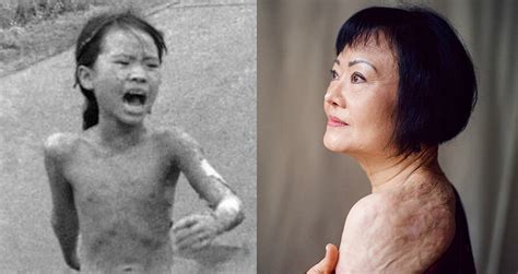 Napalm Girl The Surprising Story Behind The Iconic Photo 52 Off