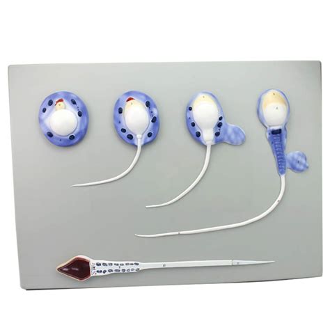 Buy Fxq Scientific Anatomical Human Model Sperm Formation Process Model Male Reproductive