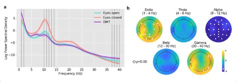Frequency Specific Changes In Spectral Power Induced By Download Scientific Diagram