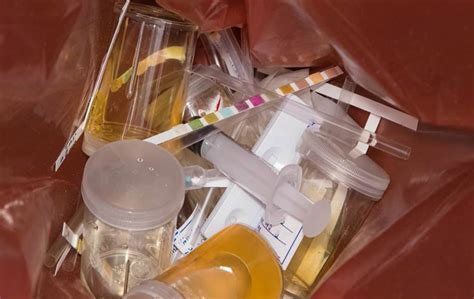 Договор на утилизацию медицинских отходов в Москве Контракт на вывоз медицинских отходов