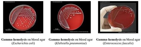 Haemolysis Of Streptococci And Its Types With Examples