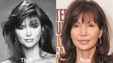 Victoria Principal Plastic Surgery Before And After Photos Latest