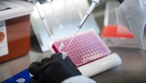 Cap Clia Laboratory For Quality Testing Mriglobal