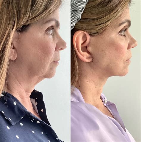 Dra Maribel Ojeda Oficial