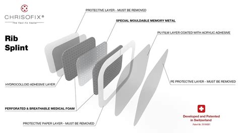 Fırat Avaneş On Linkedin Why Chrisofix®rib Splints Patients Often